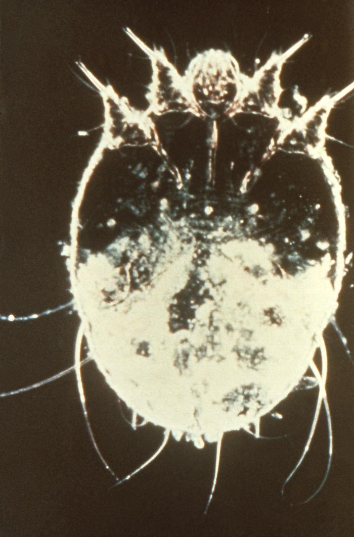 Sarcoptes scabiei - Agentes biológicos - Otros seres vivos