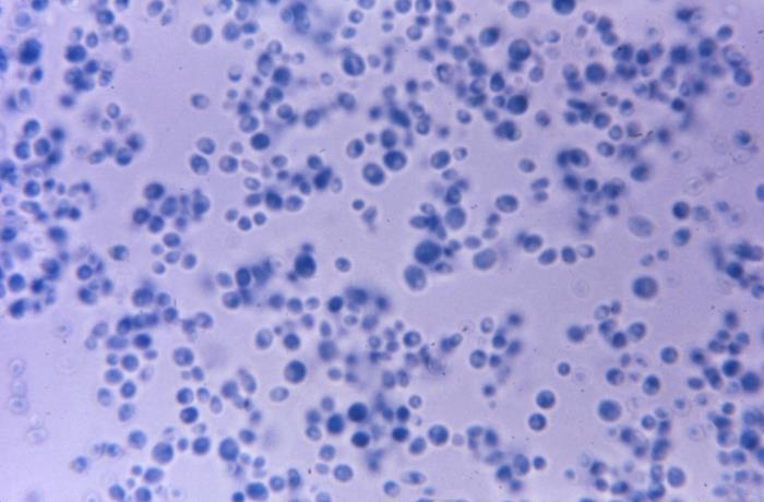 Cryptococcus neoformans var. gattii (Filobasidiella bacillispora ...