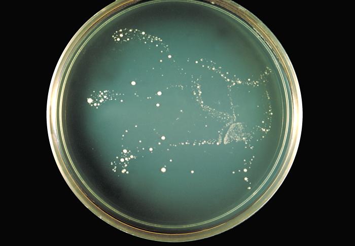 Cryptococcus neoformans var. neoformans (Filobasidiella neoformans var ...